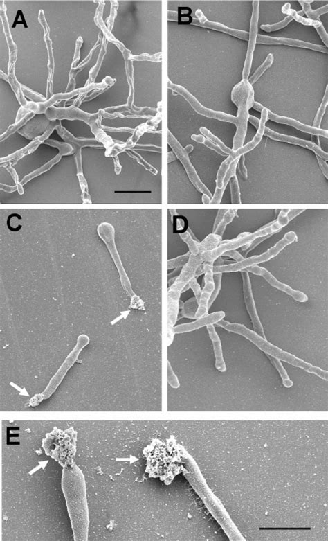 Scanning Electron Microscopy Of Hyphae Grown At 48°c Conidia Of The