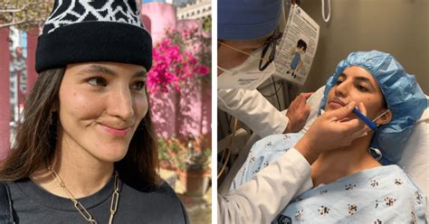 Model Brooklinn Khoury Flaunts Her Brand New Smile After Having Her