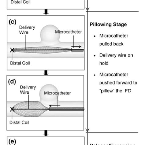 Procedure Of Fd Deployment Using The Push Pull Technique Illustrated