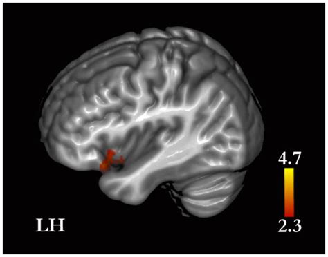 Involvement Of Cortical Midline Structures In The Processing Of