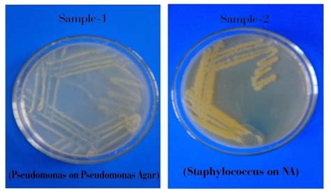 Sample1 And Sample 2 On Nutrient Agar Download Scientific Diagram