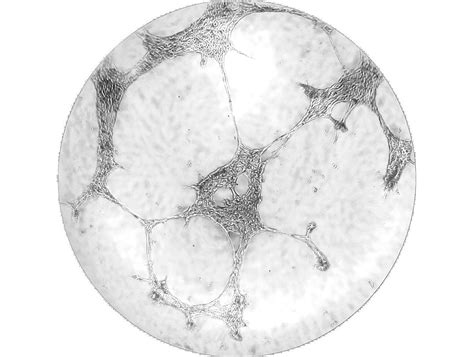 Angiogenesis Analyzer Not Working Image Analysis Imagesc Forum