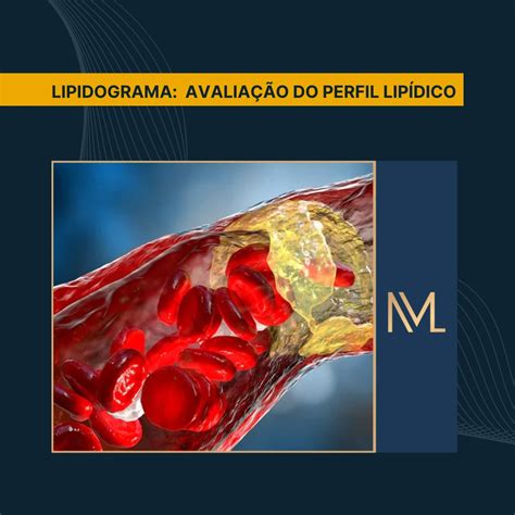 Lipidograma Avaliação Do Perfil Lipídico Inml