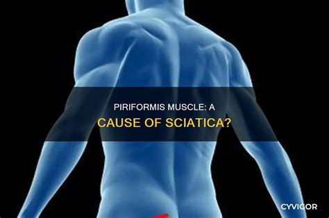 Piriformis Muscle A Cause Of Sciatica Cyvigor