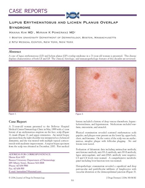 Digital Article Delivery Services On Linkedin Lupus