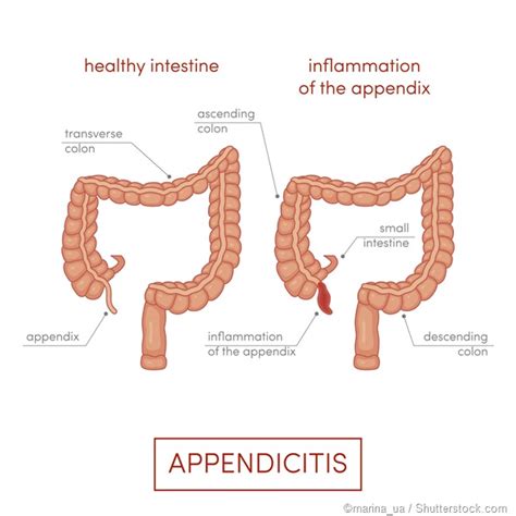What Is The Appendix