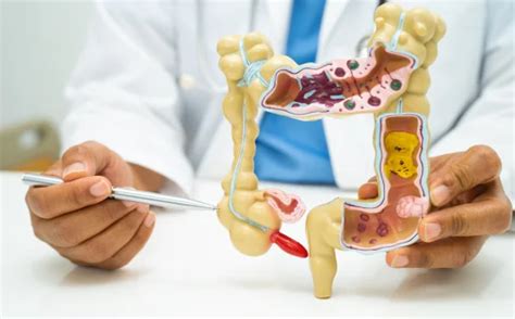 What Is Appendicectomy Surgery Medisuggest