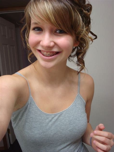 Pin By Hirohide Arimoto On Wearing Braces Cute Braces Brace Face Young Teens Fashion