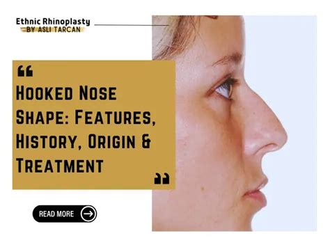 Hooked Nose Shape Features History Origin And Treatment