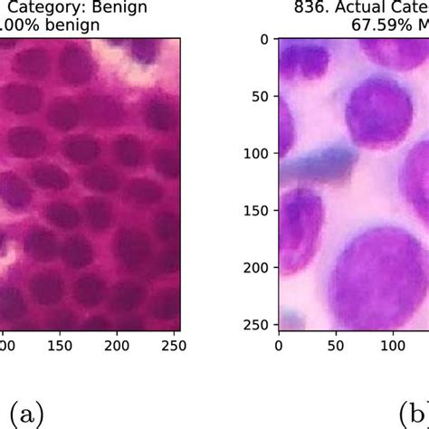 Classification Prediction For Giemsa Samples By Bfcnet Download Scientific Diagram