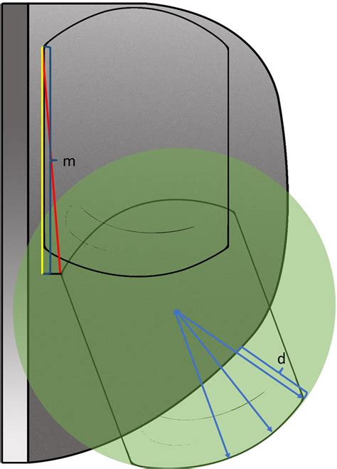 Radiological Measures Of The Prosthesis After Uka A Valgusvarus