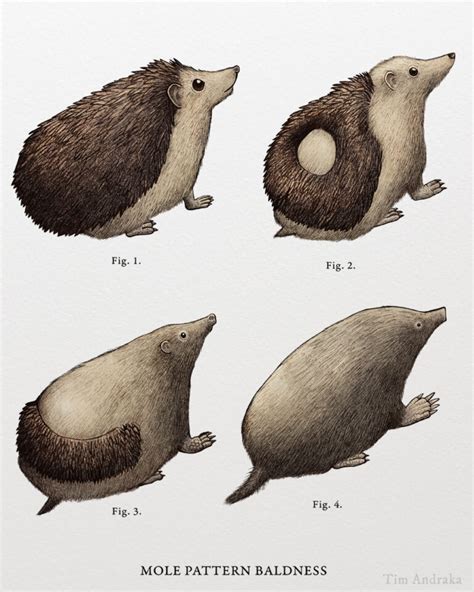 Mole Pattern Baldness Tim Andraka