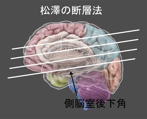 移動現象論とは？ 身近な例を紹介