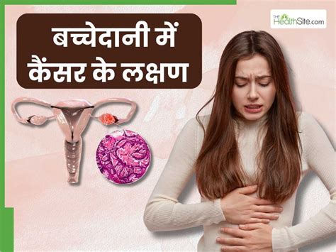Bachedani Me Cancer Ke Lakshan बच्चेदानी में कैंसर होने पर दिखते हैं