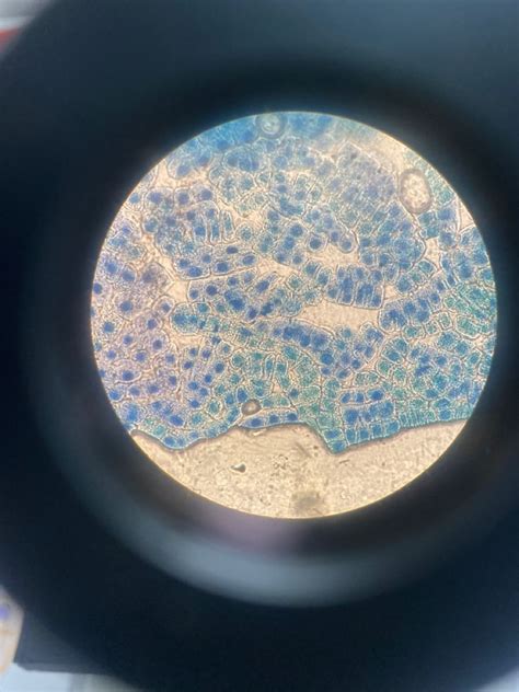 Onion Root Tip Cells Artofit