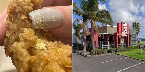Couple In New Zealand Allegedly Finds Fly Eggs In Kfc Chicken Food Safety Authorities Investigating