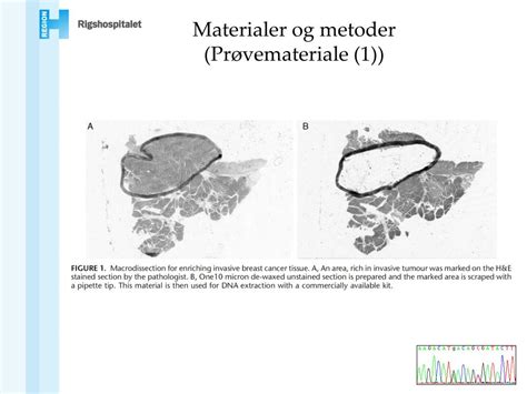 Ppt Mlpa Multiplex Ligation Dependent Probe Amplification