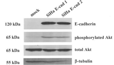 Phosphorylated Akt Expression In The E Cadherin Transfectants