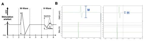 Terminal H Reflex Measurements In Mice Article Jove