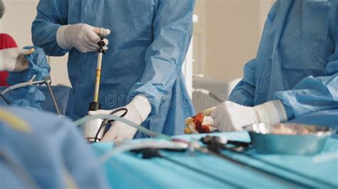 Surgeons Team During Process Operation Uterus Removal With Surgical