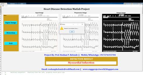 Heart Disease Detection Using Image Processing Matlab Project With