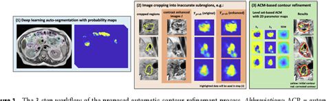 Figure 1 From Automatic Contour Re ﬁ Nement For Deep Learning Auto Segmentation Of Complex