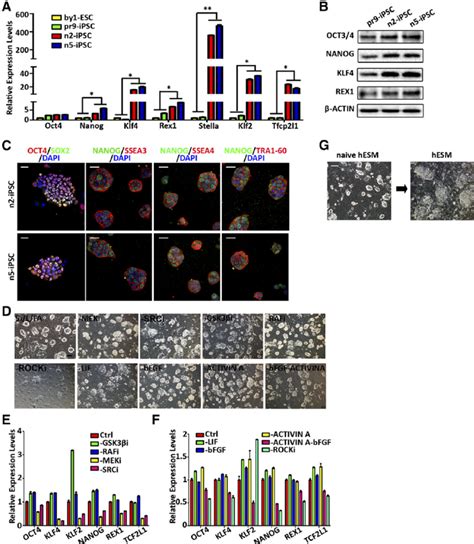 Pluripotency Validation Of The Naıve Ipscs Derived From B Thalassemia