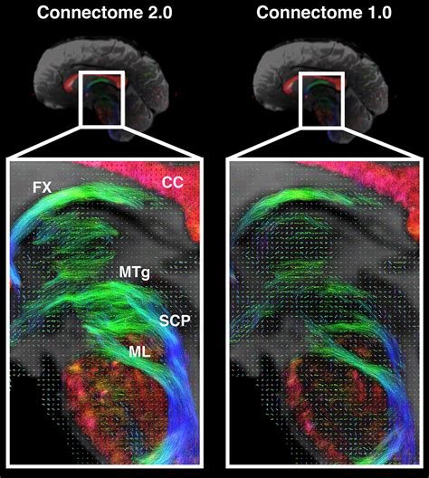 Scientists Develop High Performance Mri Scanner In Effort To Define