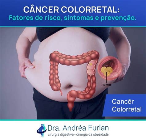 CÂNCER COLORRETAL