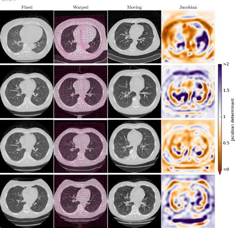 Figure 3 From Artificial Intelligence In Functional Imaging Of The Lung Semantic Scholar