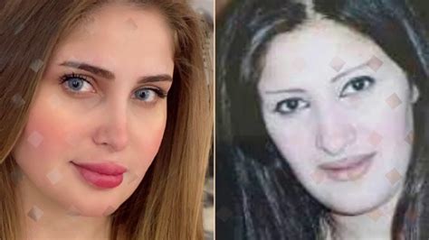 مشاهير قبل وبعد عمليات التجميل الفلوس وسخ دنيا Youtube