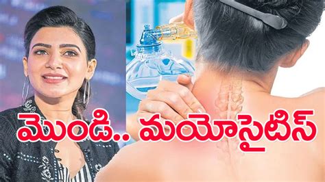 మొండి మయోసైటిస్‌ Myositis