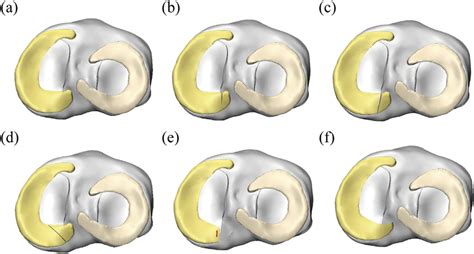 Three Dimensional Reconstructed Models Of The Knee Joint Used In The