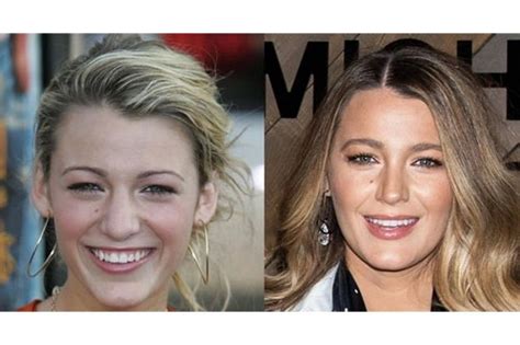 Celebrity Noses 60 Photos Moonagedaydreamfilm