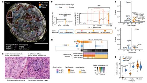 Nature ｜ 空间基因组学描绘了癌症克隆的结构、性质和进化 知乎