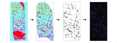 Application Of Bonej In The Measurement Of Tb Th And Tb Sp Movat