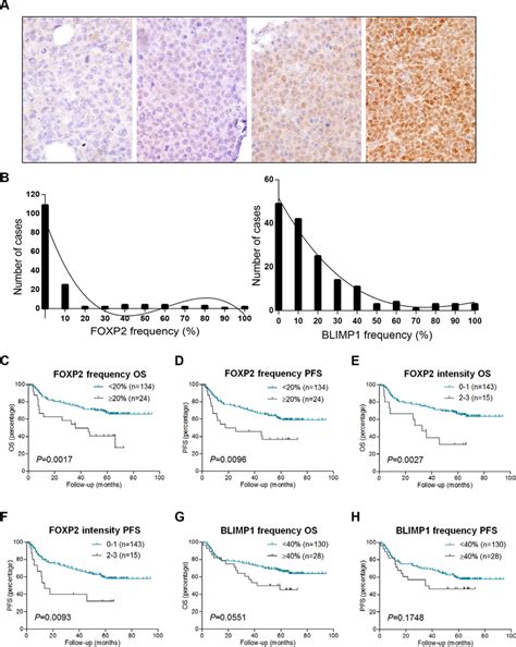 Foxp2 Expression Confers Inferior Survival In R Chop Treated Dlbcl