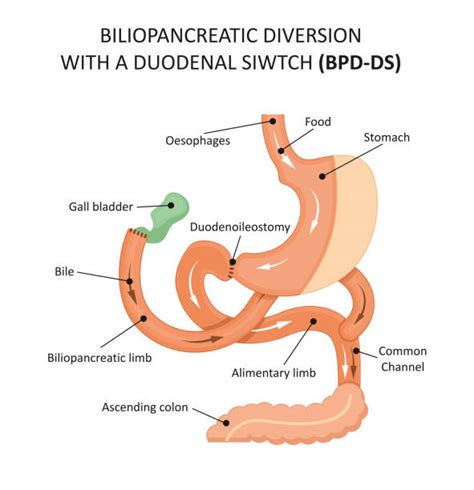 3000 Duodenum Stock Illustrations Royalty Free Vector Graphics