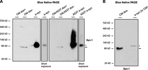 Secreted And Recombinant Syn Forms Have A Different Electrophoretic Download Scientific Diagram