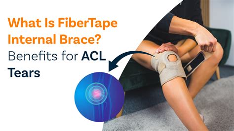 What Is Fibertape Internal Brace Benefits For Acl Tears