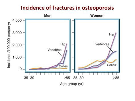 Ppt Drugs Used For Treatment Of Osteoporosis And Rickets