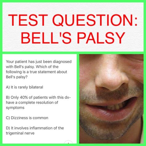 Bell S Palsy Vs Stroke Bells Palsy Patient Education