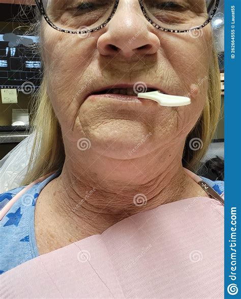 Dentistry Tooth Imprint For A New Crown Stock Image Image Of Mold