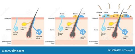 Sweat Glands Apocrine Eccrine And Sebaceous Gland Cross Section Of