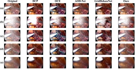 processing result comparison of dcp [3] oce [4] aod net [7
