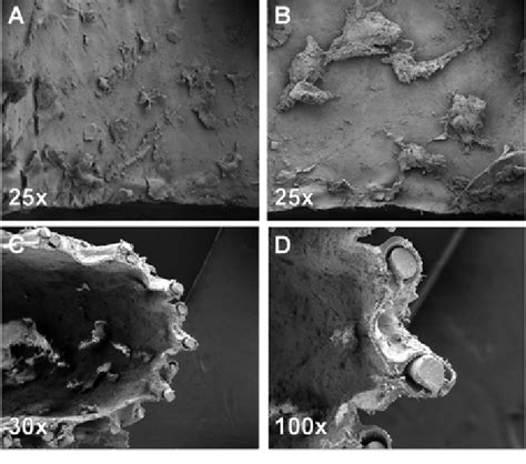 Sem Micrographs Of The Retrieved Hot Axis Stent Abluminal View