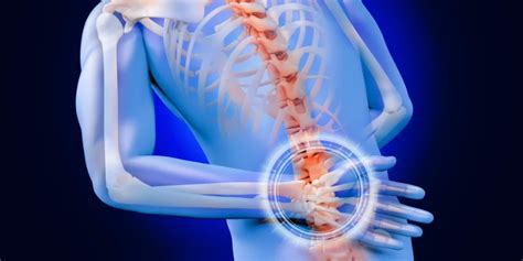 Servikal Spondiloz Nedir Ve Neden Olur — Ios Bilgi