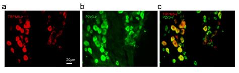 Trpm8 Immunoreactivity In Vg Neurons A Image Shows Trpm8