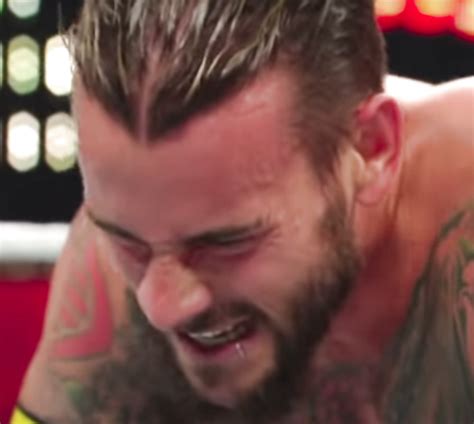 Cm Punk Nose Image 3468427 Thisvid Tube
