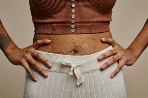 Close Up Of Woman Belly With Real Skin Texture And Acne Scars Stock